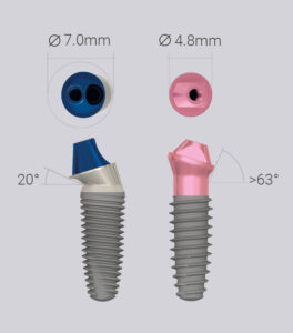 Oxy Dental Implant – Fixo Dental Implants: Precision-Engineered for ...